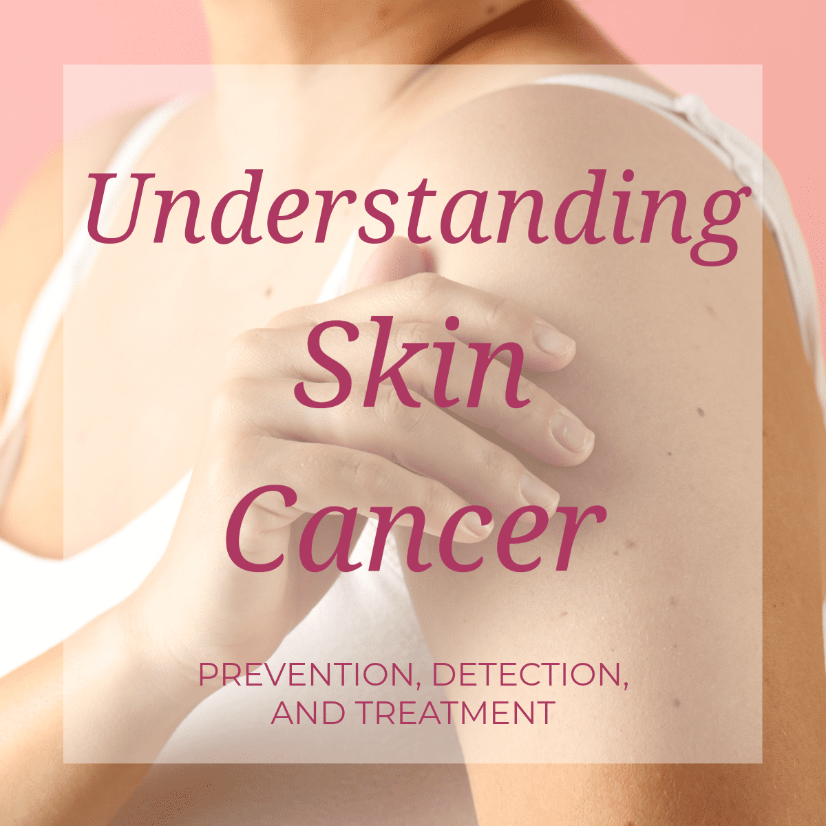 Understanding Skin Cancer: Prevention, Detection, and Treatment - Mona ...
