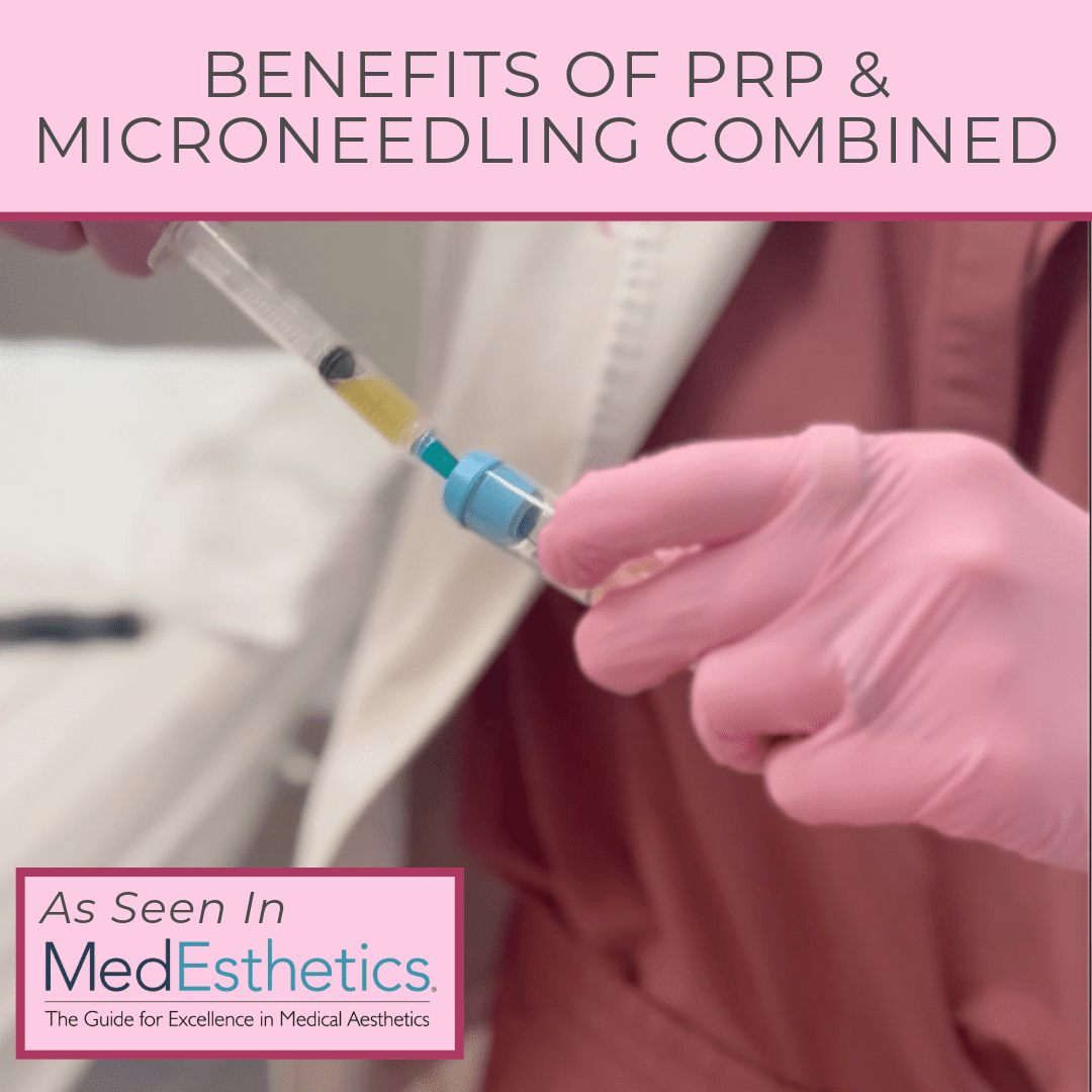 Benefits of PRP and Microneedling Combined